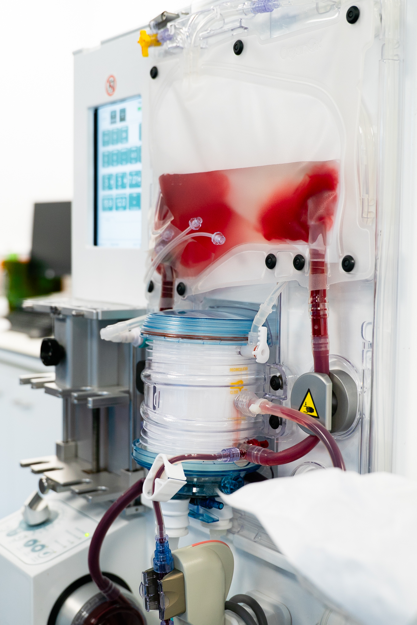 Innovation Incoming: Adventures in organ preservation